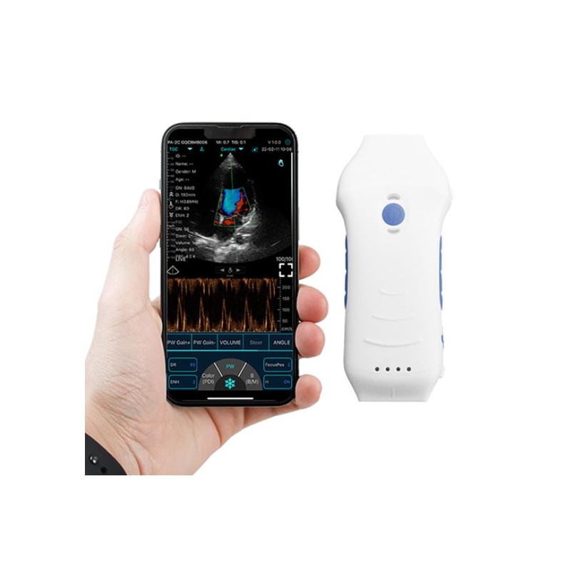 Konted AO-C10HL New Dual-probes Multipurpose Ultrasound Phased + Linear ...